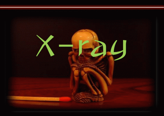 x-ray 엑스레이