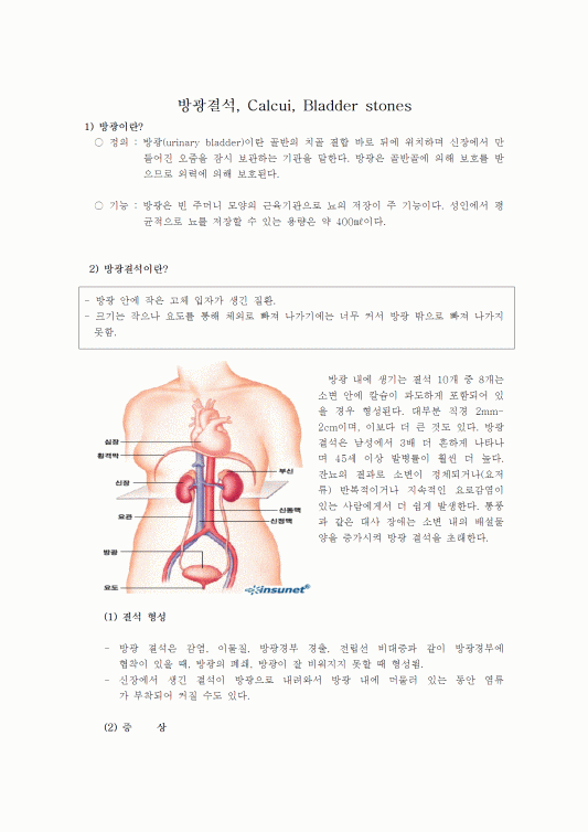 방광결석 문헌고찰