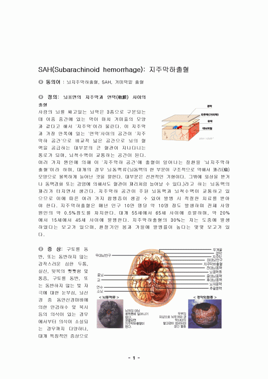 SAH 문헌고찰입니다^^