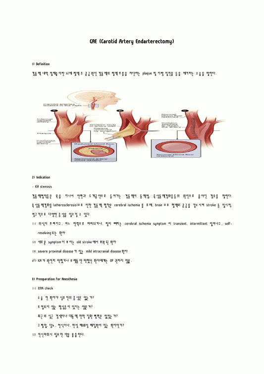 CAE (Carotid Artery Endarterectomy)
