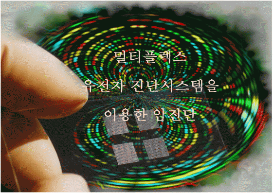 멀티플렉스 유전자진단시스템을 이용한 암진단