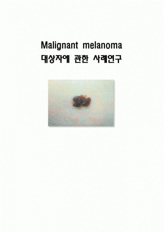 Malignant melanoma 케이스 - 자료 및 방법, 문헌고찰, 간호과정, 결론 및 제언