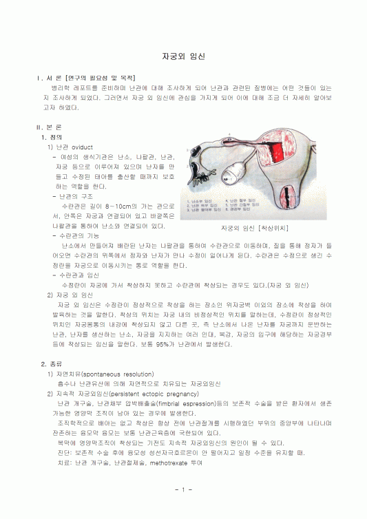 자궁외 임신  병리학 종류 진단 치료