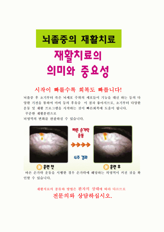뇌졸중 환자의 재활치료