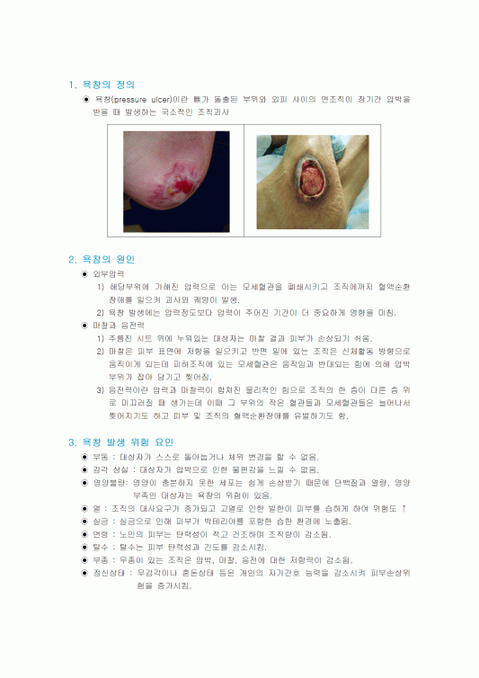 성인간호 - 욕창