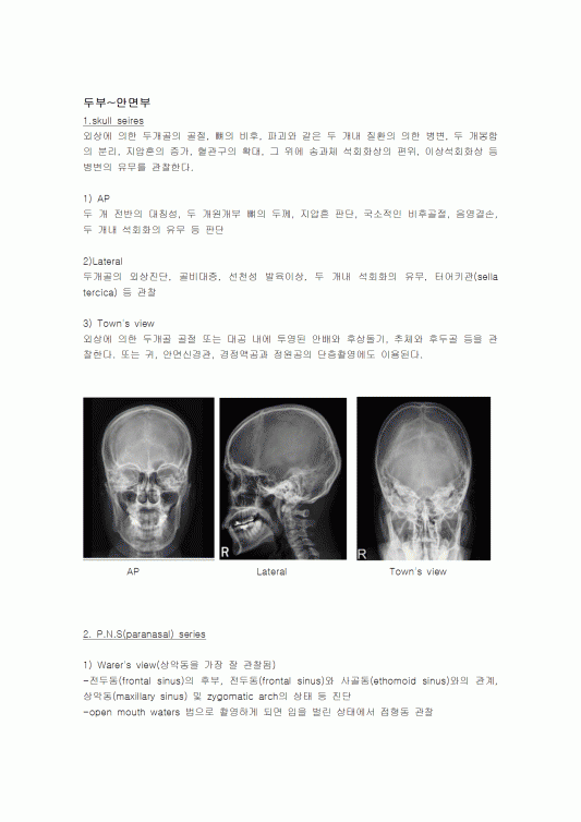 X-ray에 대해 레포트 자료