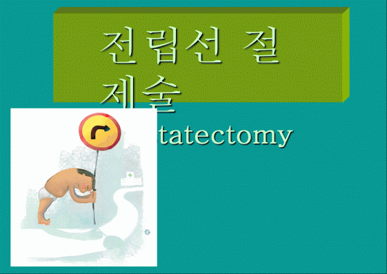 전립선절제술PPT