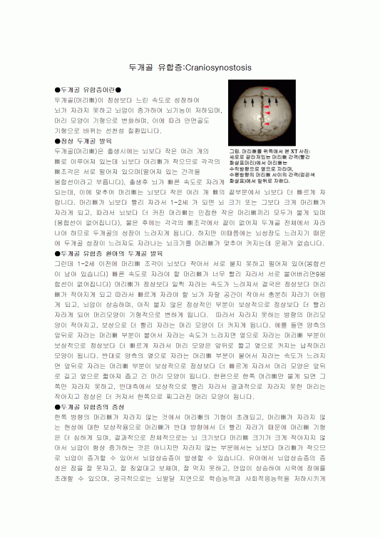 아동간호실습case-두개골유합증 과 수두증 입니다.