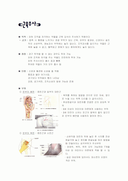 근육주사에 대해