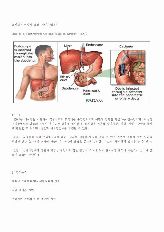 내시경적 역행성 췌관