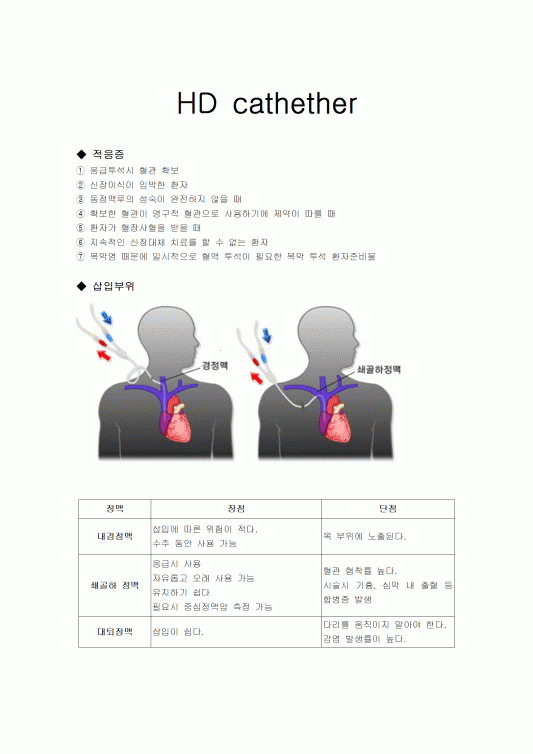 HD catheter 레포트 자료