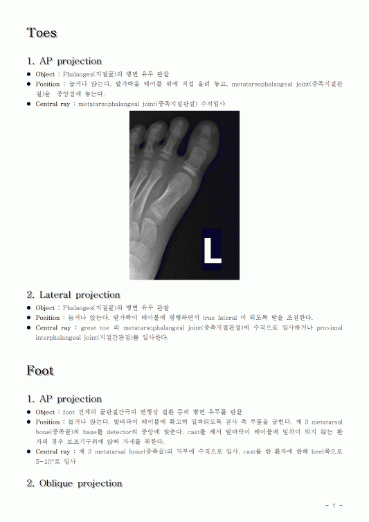 Toes(지절골,방사선)