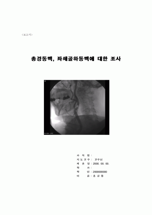 총경동맥, 좌쇄골하동맥에 대한 조사