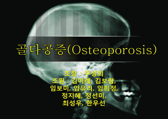 골다공증(Osteoporosis)