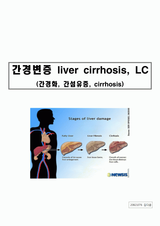 성인간호학 (소화기내과) 간경변증