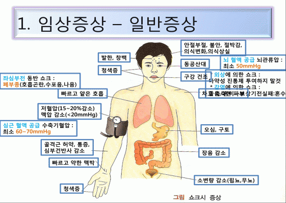 쇼크임상증상