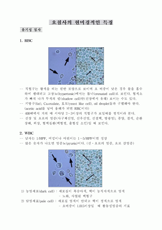 요침사의 현미경적인 특징