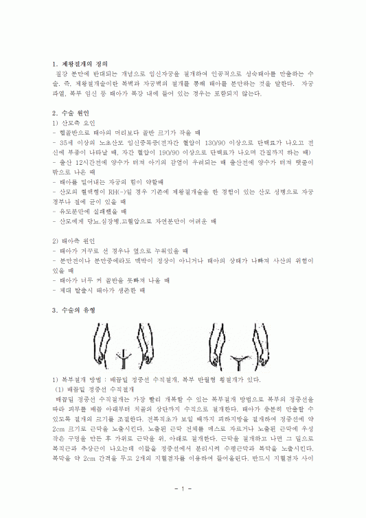 제왕절개술 의학