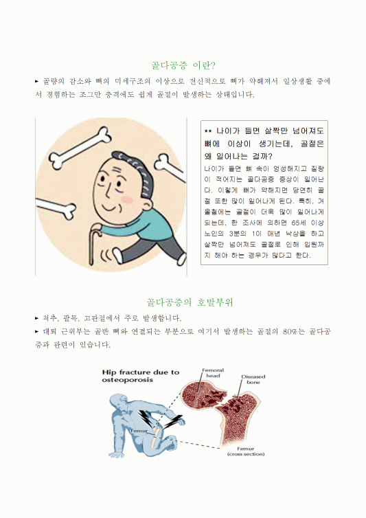 [자연과학] 골다공증