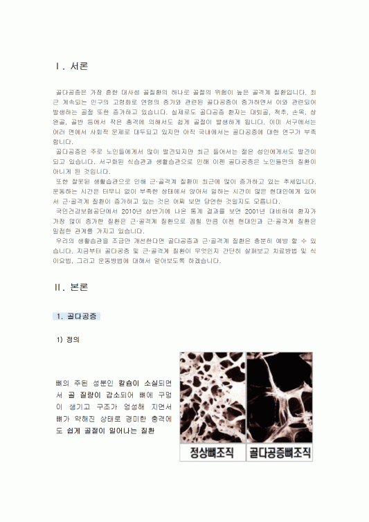 골다공증, 근골격계질환