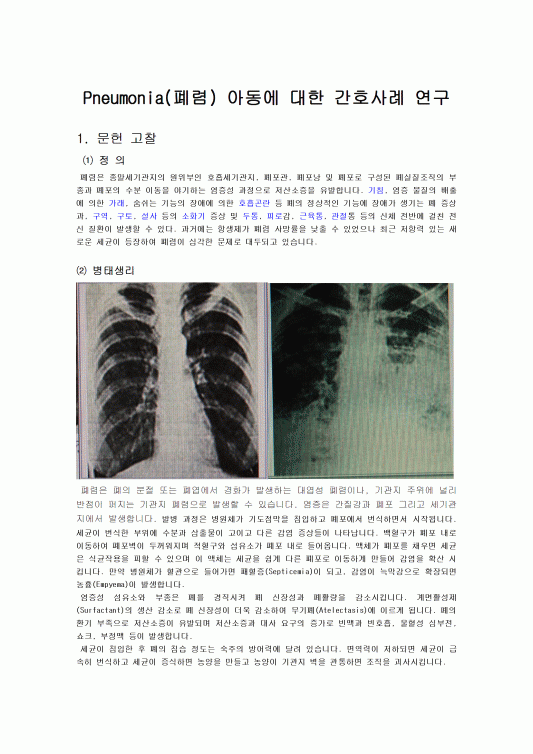 [아동간호 케이스] Pneumonia(폐렴) 아동에 대한 간호사례 연구