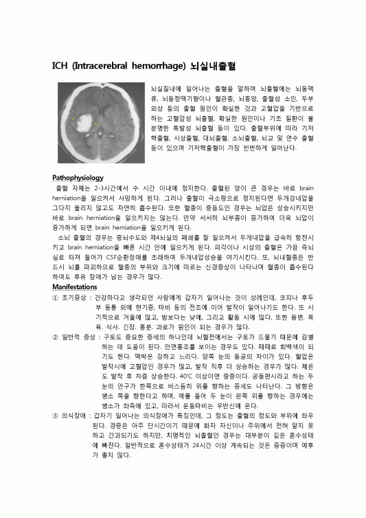 ICH 레포트 자료