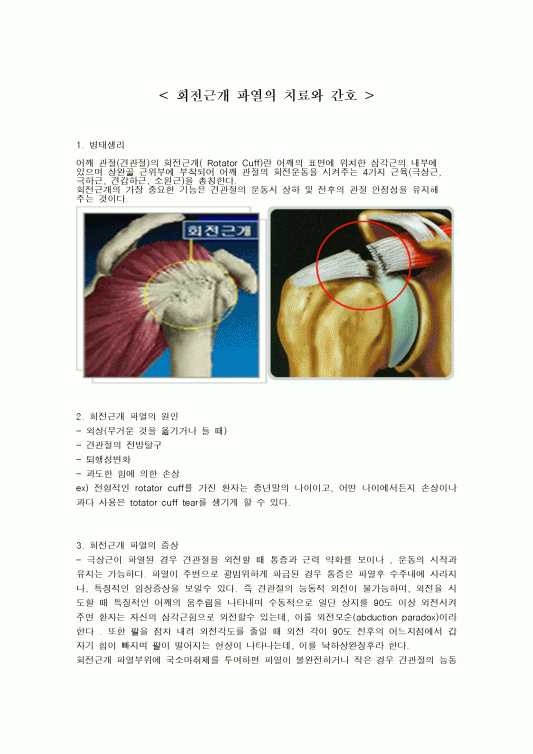 회전근개 파열의 치료와 간호