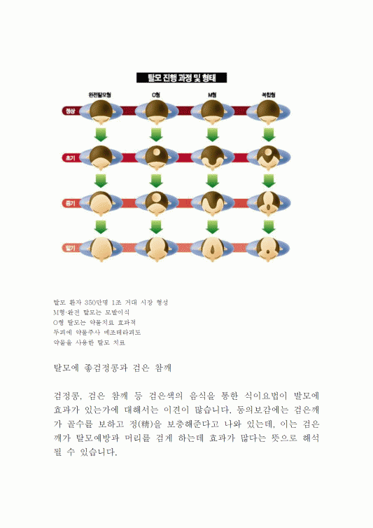 탈모진행과정 및 탈모방지음식 소개