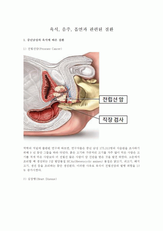육식, 음주, 흡연과 관련된 질환