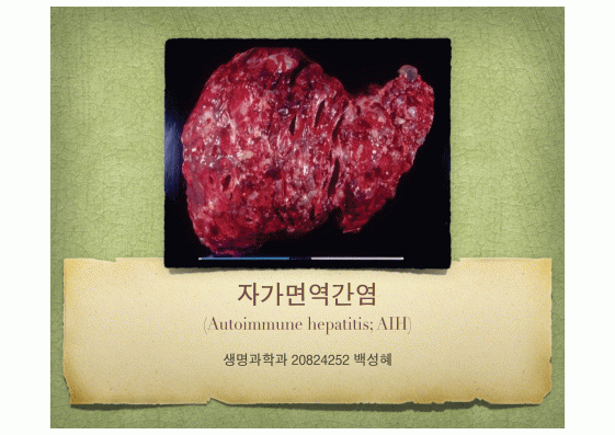 자가면역간염pdf