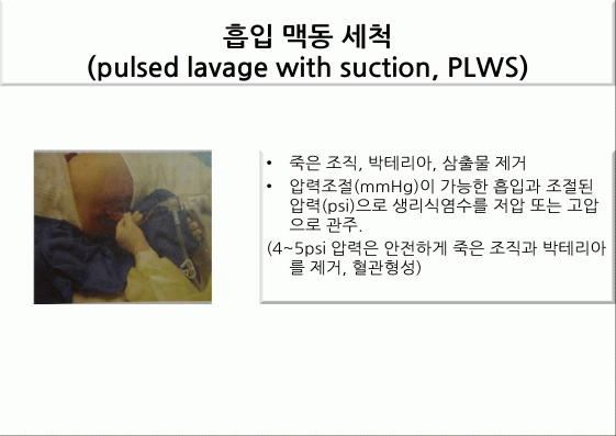 피부계 레포트 자료