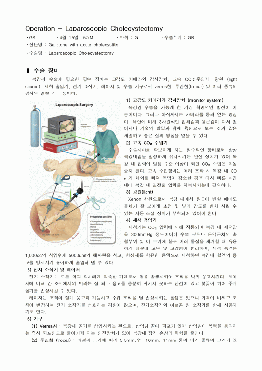 [성인간호학]_수술방_case_Laparoscopic_Cholecystectomy