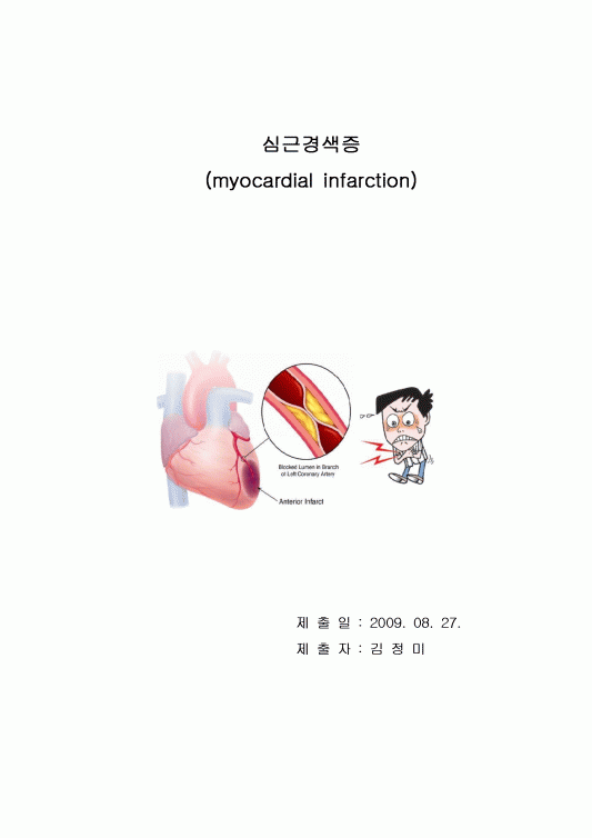 MI 레포트 자료