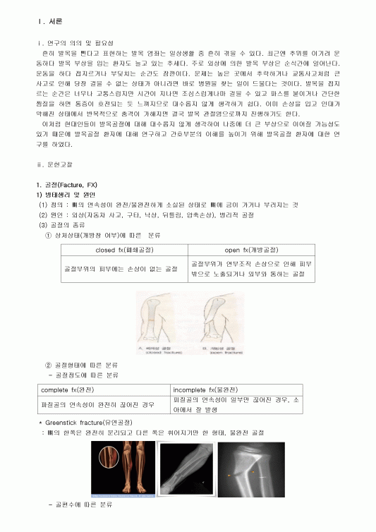 Lt. distal tibia & fibular Fx