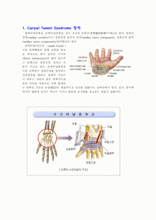 물리치료 팔목터널증후군