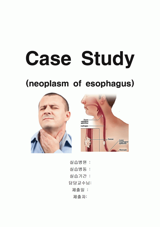 Case Study-식도암
