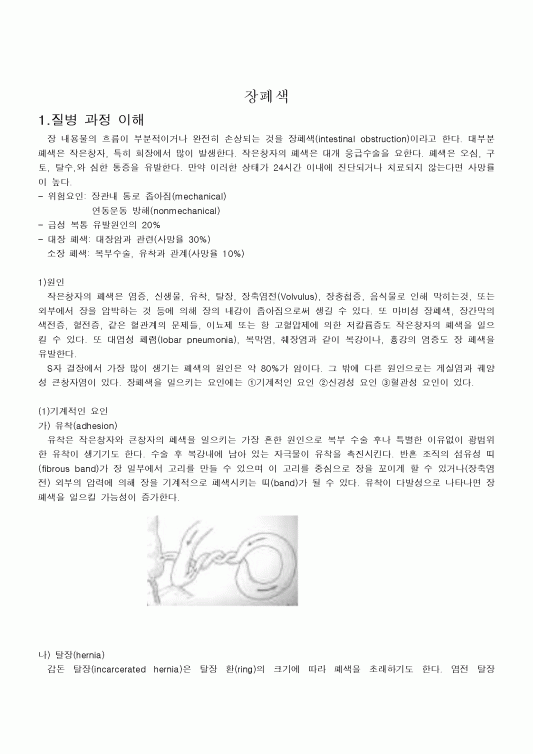 장폐색 레포트 자료