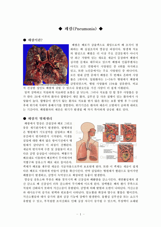[의약학] 폐렴