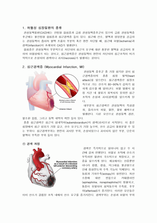 Myocardial Infarction(MI, 심근경색증)