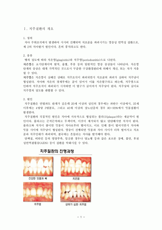 치주질환레포트