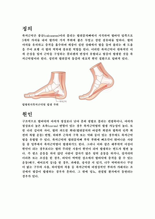 운동재활 프로그램 족저근막염