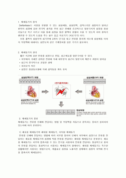 제세동기 사용방법