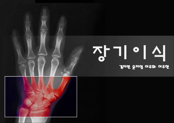장기이식 생명윤리