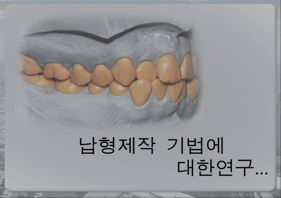 납형제작 기법에 대한 연구.ppt