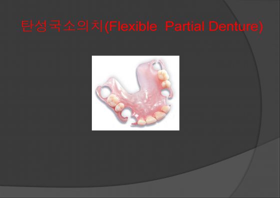 탄성국소의치(Flexible partial denture).ppt