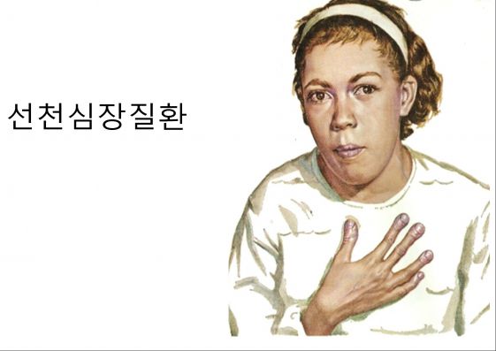 선천심장질환.ppt