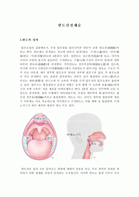 편도선절제술