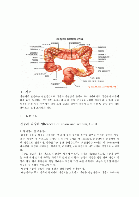 결장과 직장암, 장