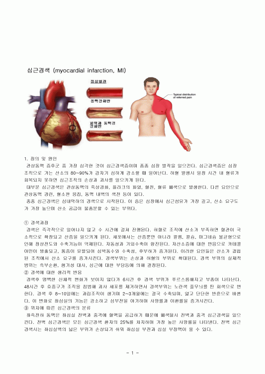심근경색 [자연과학]