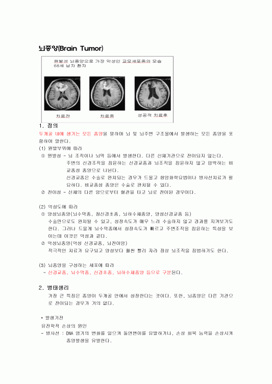 [신경외과] 뇌종양(Brain Tumor)